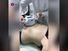 cavitazione di 20MHZ rf 100kPa 25m3/H che dimagrisce macchina