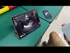 China Ultrasound Color Doppler Diagnostic Ultrasound Equipment Download Software From App Store or Google Play 3 In 1 Wireless for sale
