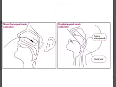 Oral Nasal Swab with Breakpoint for Virus Sample Collection
