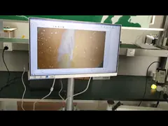 colposcope