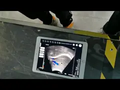 Ανιχνευτής υπερήχου Doppler χρώματος Wifi εγκυμοσύνης με τη μέτρηση Ob/Gyn