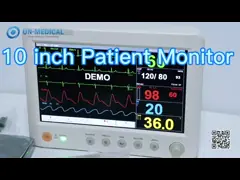 L‘Hôpital de l‘UCI ha istituito un sistema di rilevamento della fibrillazione, che è stato istituito dal team dell‘Hôpital de l‘UCI.