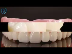 China ISO Zirconia Dental Crown Computer Numerical Control Processing Good Biocompatibility for sale