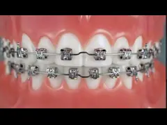 China FDA PFM Dental Bridge Good Biocompatibility 3D Printing Dental Models for sale