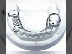 China Dental Brackets Orthodontics Fixed Tooth Modeling Tools Dental Braces for sale