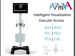 Ultrasound-guided PTA