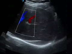 uc5-2e