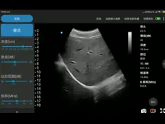 CE Marked 3.6MHz Convex Probe Compatible with Android and iOS System