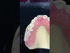 3D Print Model High Esthetics Dental TCS Valplast Flexible Partial Dentures Dental Lab