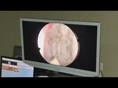 Хирургическое устройство высокочастотный генератор плазмы радиочастот