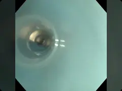 Tracheal Collapse & Bronchoscopic Anatomy