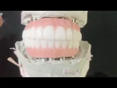 Porcelain All On Four Zirconia Bridge High Esthetics Dental Implant Bridge