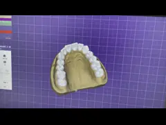 CAD/CAM digital precise cutting, creating the beautiful and natural high-quality oral restorations.