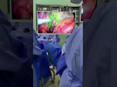 4K Fluorescence Endoscope camera System