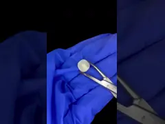 고품질 의 세라믹 인레이 및 온레이, 원활 하고 오래 지속 되는 치아 복원