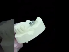 Impianto dentale a corona in titanio a lunga durata per sostituzione di denti mancanti