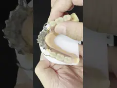 금속 합금 부분 코발트 크롬 치아 Ivoclar Scheftner 편안한 금속 프레임