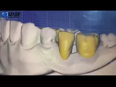 China Advanced Opposite Jaw Model Resin Customized Dental Model Resin for sale