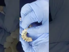 Quick Turnaround Full Contour Zirconia Crown for Perfect Fit / Aesthetic Comfort