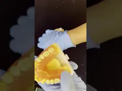 China Durable Dental Prosthesis Full Arch Acrylic Teeth Partial Removable Dentures for sale