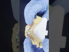 China Printed Scheftner Metal Partial Denture Framework Accurate Customized Cast Partial Denture for sale