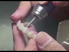 Come creare corone e ponti dentali di alta qualità in laboratorio