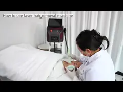 Cina 808nm diodo laser depilazione macchina 2000W diodo laser macchina per la depilazione in vendita