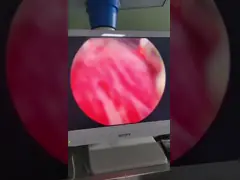 China Orthopedics Spinal Surgery Monopole Detector Probe Improve Prognosis Low Temp Cutting for sale