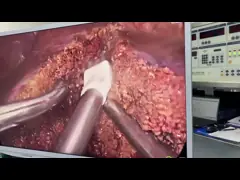 Cina All In One Coblation Plasma Chirurgical Unit Coblator Machine con sonda multifunzione in vendita