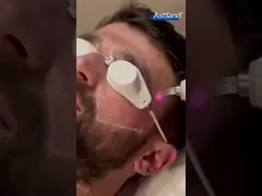 Laser hair removal ｜before & after