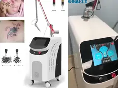 Picosecond Laser 532nm 755nm 1064nm Vertical Q Switch Picosecond Laser Machine for Acne Removal