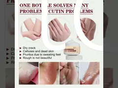 China OEM ODM Hand And Foot Care Cream Anti Cracking Dry Peeling Repairing Cracks for sale