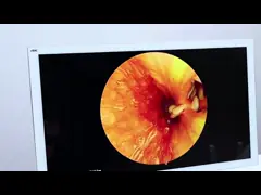 TU-Y5D101B Full HD Endoscopy Camera with Adjustable Light for ENT and Laparoscopic Surgery