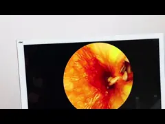 TUYOU High-Definition Endoscope Camera System for Nasal, Ear, and Laparoscopic Procedures