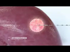 China Gyn Radio Frequency Probe For Uterine Fibroids Liver Tumor And Lung Tumor Ablation for sale