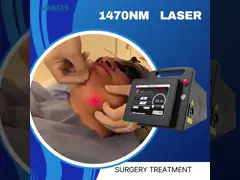 China 1470nm Face Lifting Lipolysis Laser Liposuction Machine Laser Fat Removal Endo Face Lifting 1470nm Machine for sale