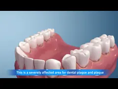electric toothbrush 2