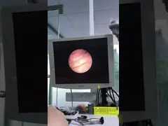 LINVATEC HD 4300 アルトロスコープ 修理のため