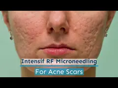 China 2025 The Most Popular 2 In1 Face Lifting Machine Skin Rejuvenation Wrinkle Remover Home Use Beauty Equipment Beauty Aesthetic Machine for sale