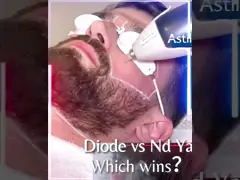 Diode Laser vs ND YAG Laser, which one you prefer?
