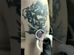 Macchina laser di picosecondi 3 in 1 - Rimuovi macchie e tatuaggi in modo sicuro