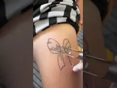 3-in-1 Picosecond Laser Machine - Remove Spots & Tattoos Safely
