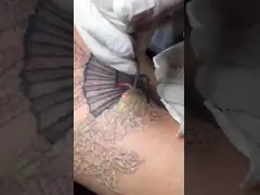 3-in-1 Picosecond Laser Machine - Remove Spots & Tattoos Safely