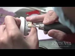 Grassshopper Veneers The Perfect Solution For Natural Translucency Dental Veneers