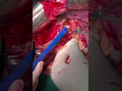 China Clinic Hepatology Probe PLA408 for Open Surgery for sale