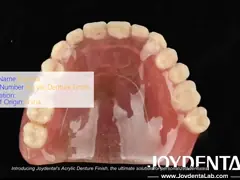 良質な生物互換性 パーソナライズされたカスタマイズ アクリル製歯入れの仕上げ 軽量で耐久性のあるソリューション