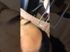 3-in-1 Picosecond Laser Machine - Remove Spots & Tattoos Safely
