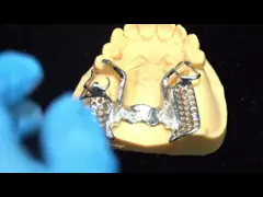 China Metal Alloys Partial Cobalt Chrome Dentures Ivoclar Scheftner Comfortable China Dental Lab for sale