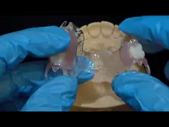 Flexible Clear Metal Cast Framework Partial Dentures High Esthetics Perfect Fit