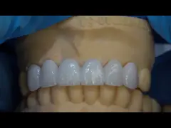 China Full Contour Zirconia Crown Translucency 3D PRO No Porcelian Overlay Standard Dental Lab for sale